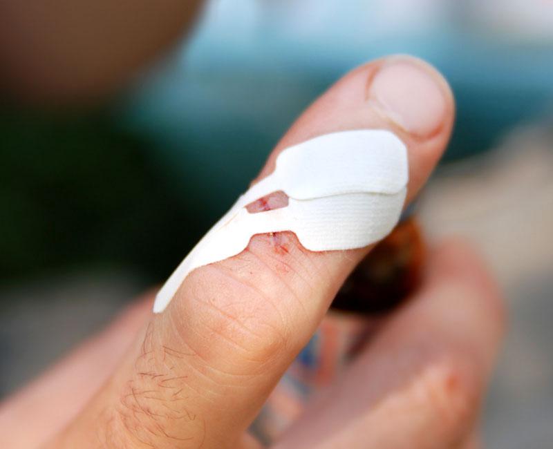 Steri-Strips (Butterfly Bandage): How To Apply & Remove Them - Wockr